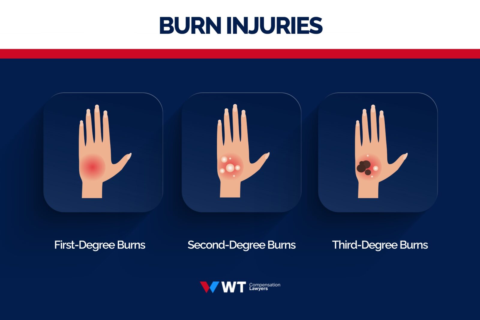 Burn Injury Compensation, QLD